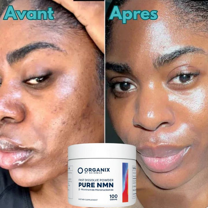 Organix™ - Poudre pure de NMN (Nicotinamide Mononucléotide) – Vitapharm